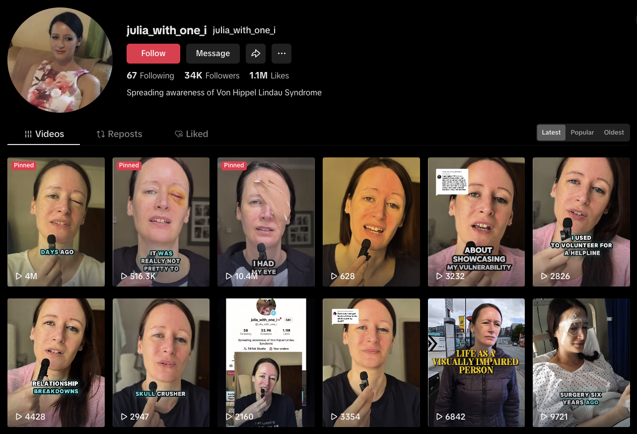 Living with VHL: A Q&A with Julia with One Eye - VHL Alliance